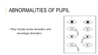 Abnormal reactions of pupil | PPTX