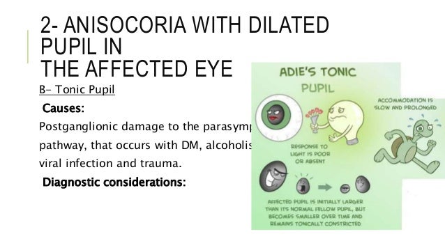 Abnormal reactions of pupil