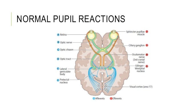 Abnormal reactions of pupil