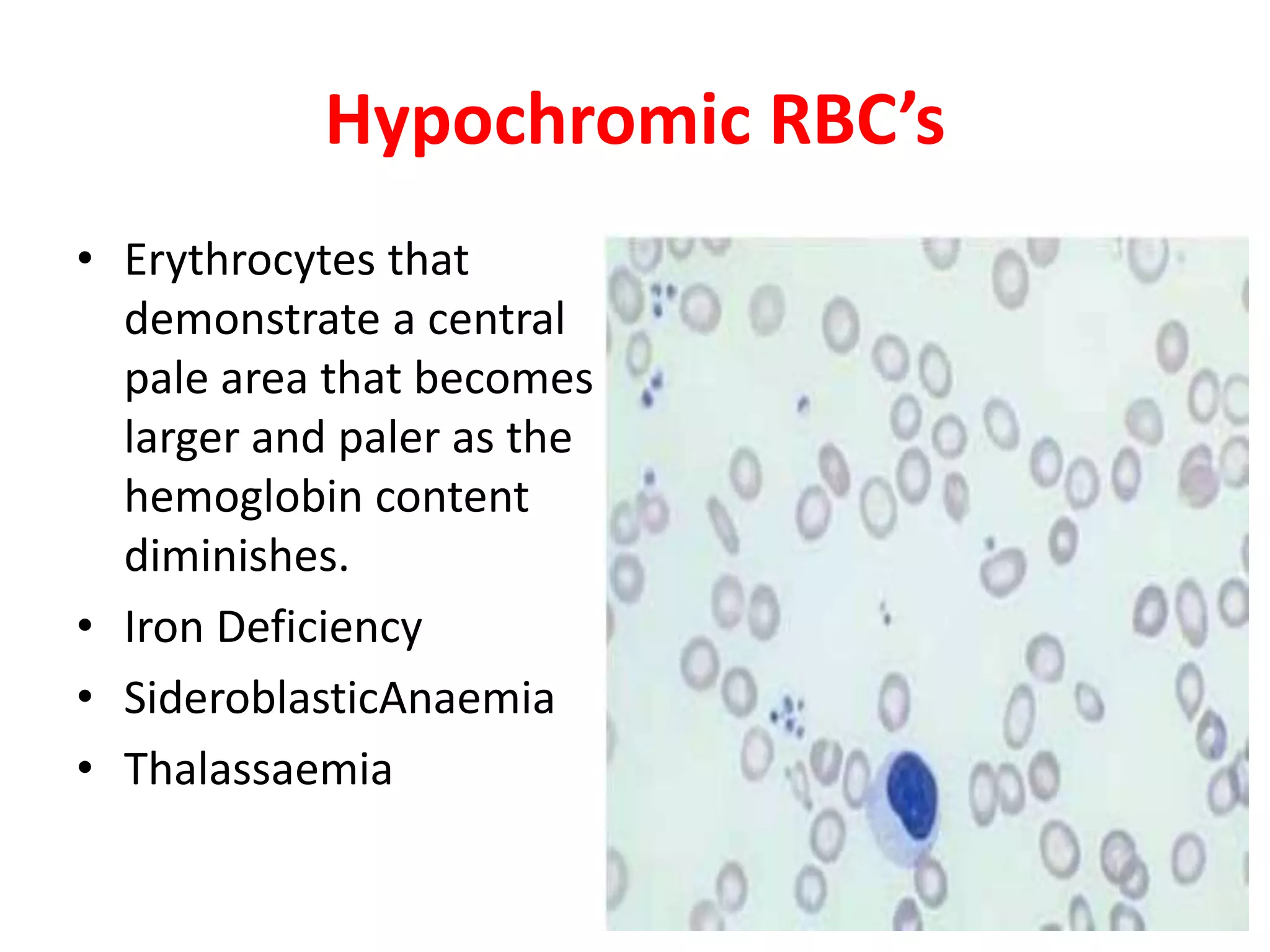 Abnormal red blood cell morphologies | PPTX