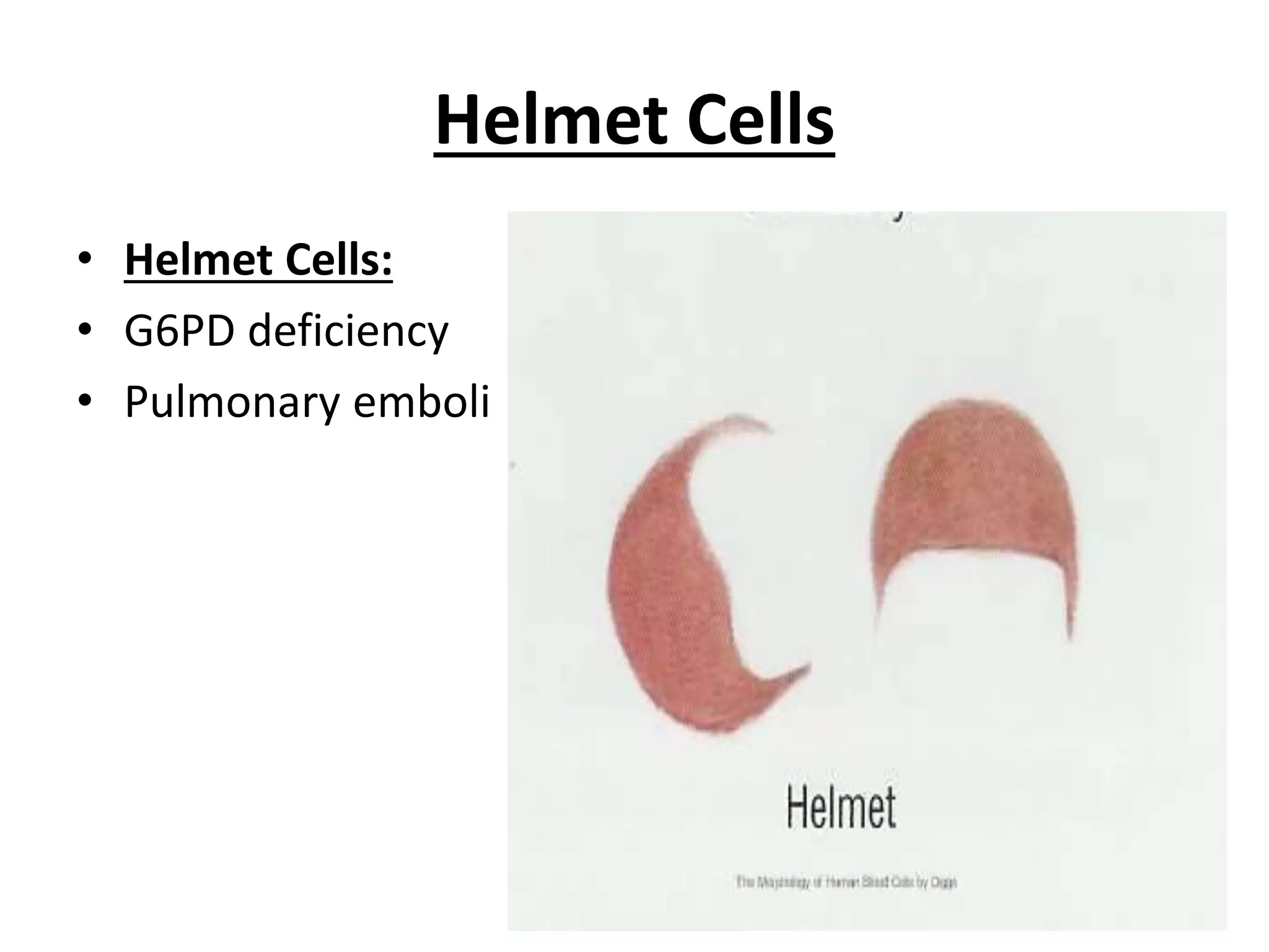 Abnormal red blood cell morphologies | PPTX