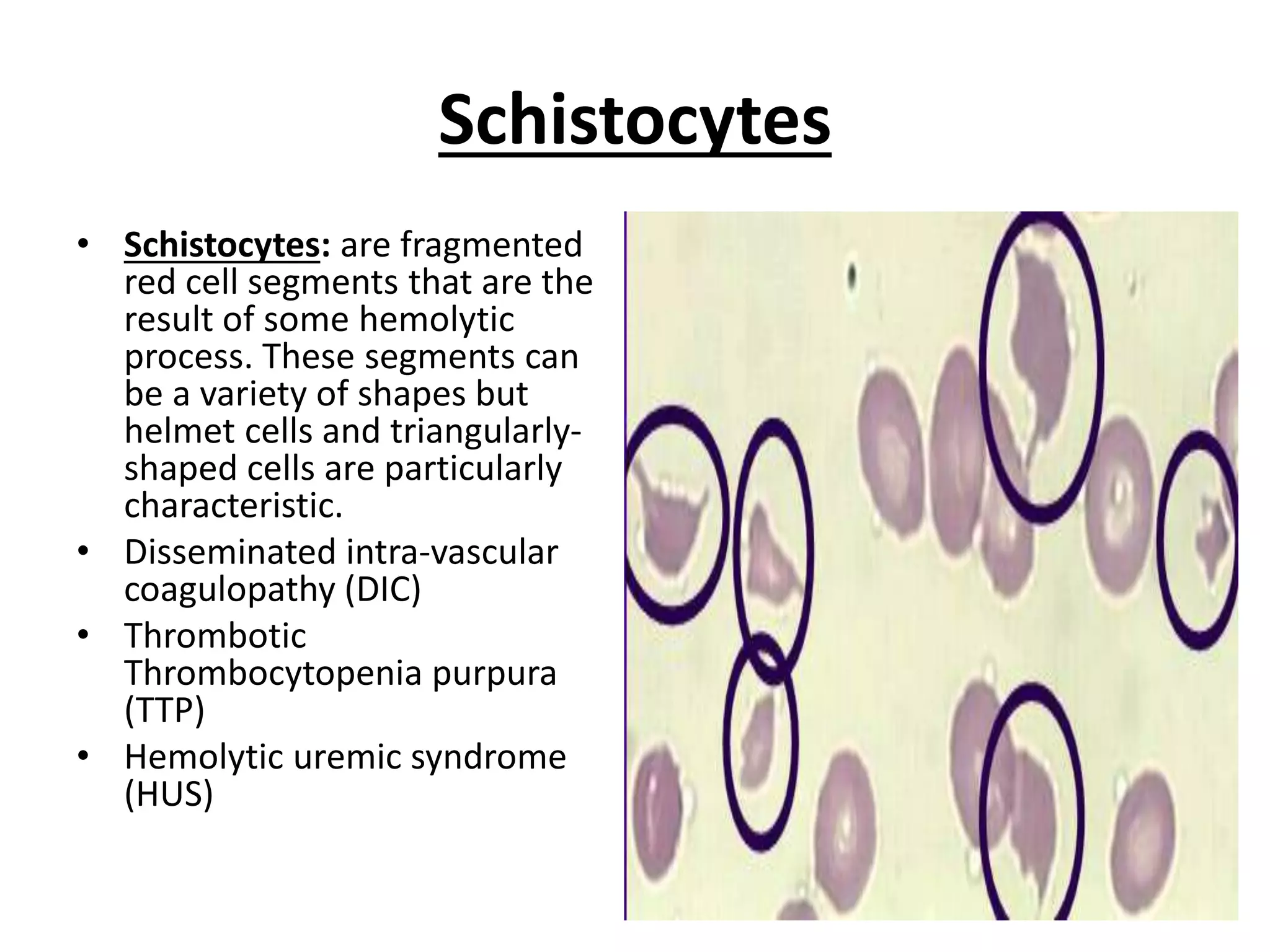 Abnormal red blood cell morphologies | PPTX