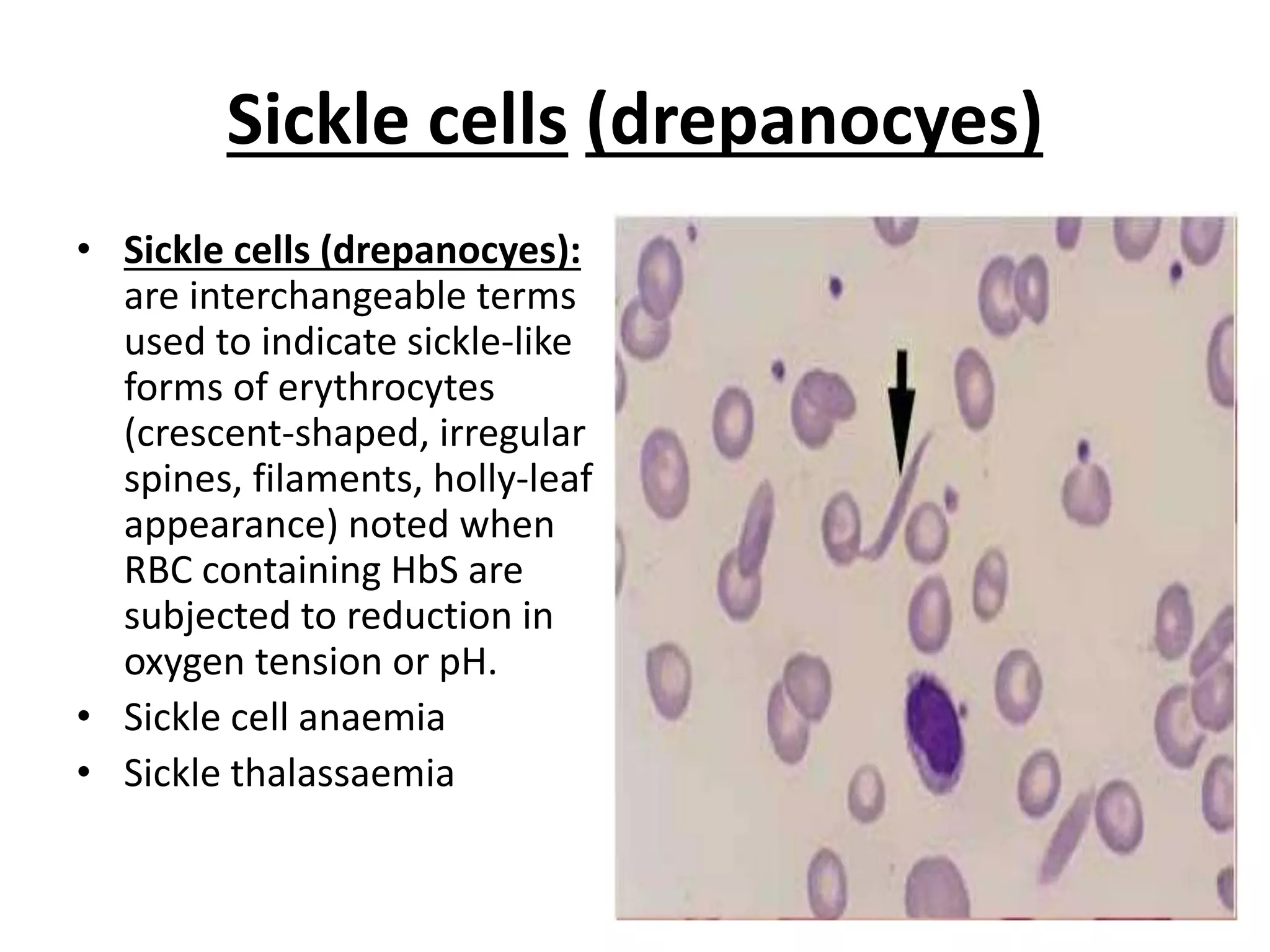 Abnormal red blood cell morphologies | PPTX