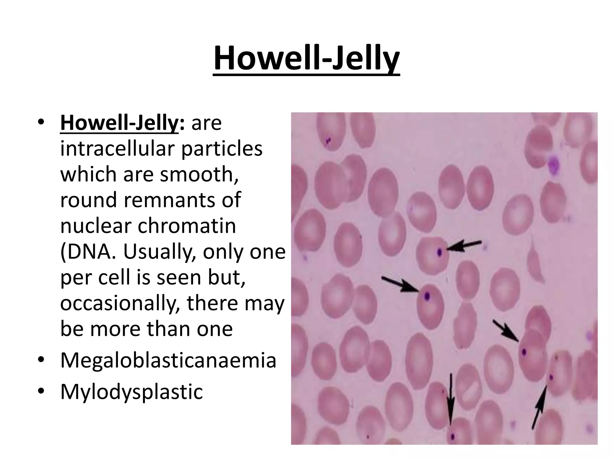 Abnormal red blood cell morphologies | PPTX