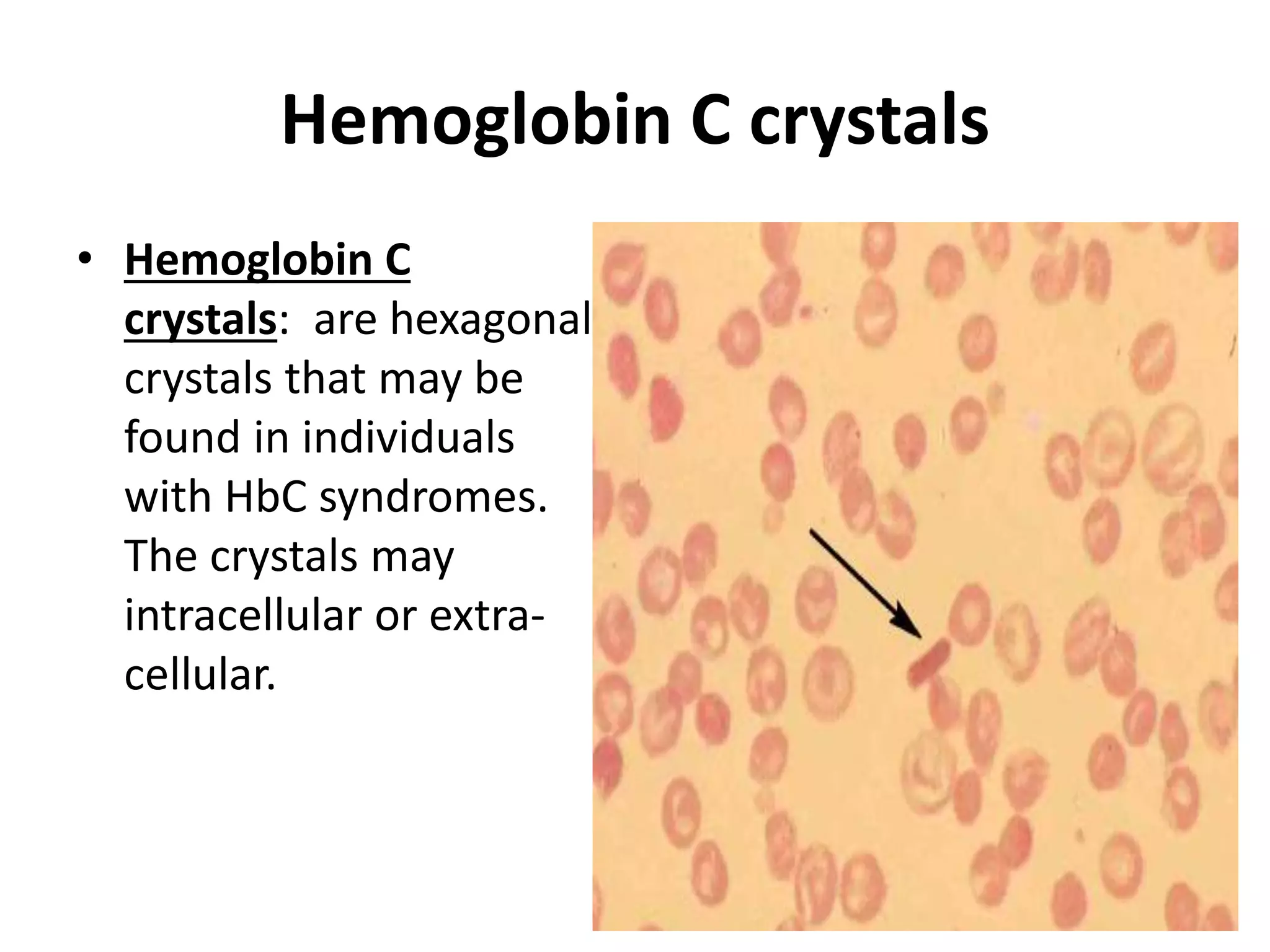 Abnormal red blood cell morphologies | PPTX