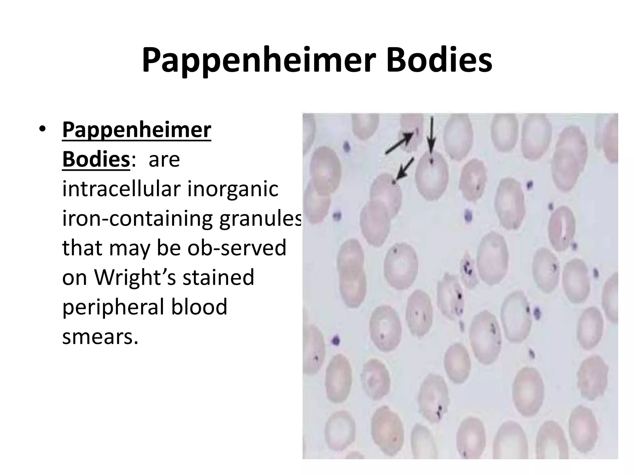 Abnormal red blood cell morphologies | PPTX