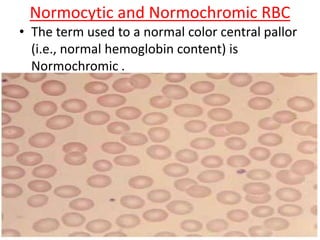 Abnormal red blood cell morphologies | PPTX