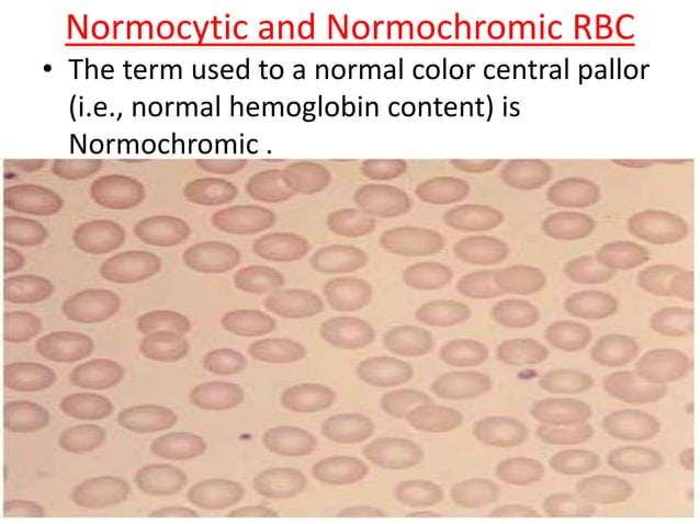Abnormal red blood cell morphologies | PPTX