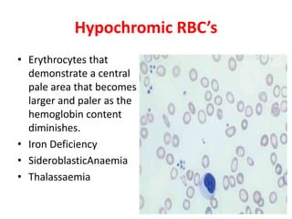 Abnormal red blood cell morphologies | PPTX