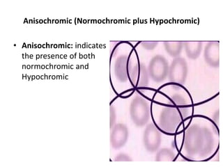 Abnormal red blood cell morphologies | PPTX