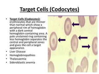 Abnormal red blood cell morphologies | PPTX