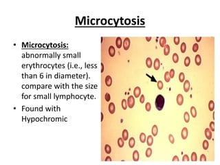 Abnormal red blood cell morphologies | PPTX
