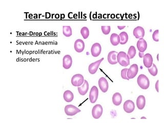 Teardrop Cell