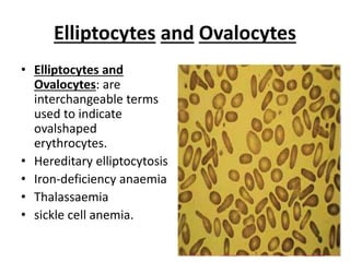 Ovalocytes