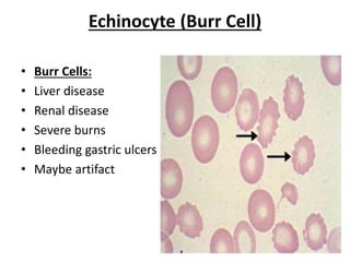 Helmet Cells Vs Bite Cells