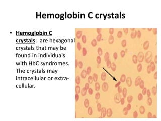 Hemoglobin C Crystals