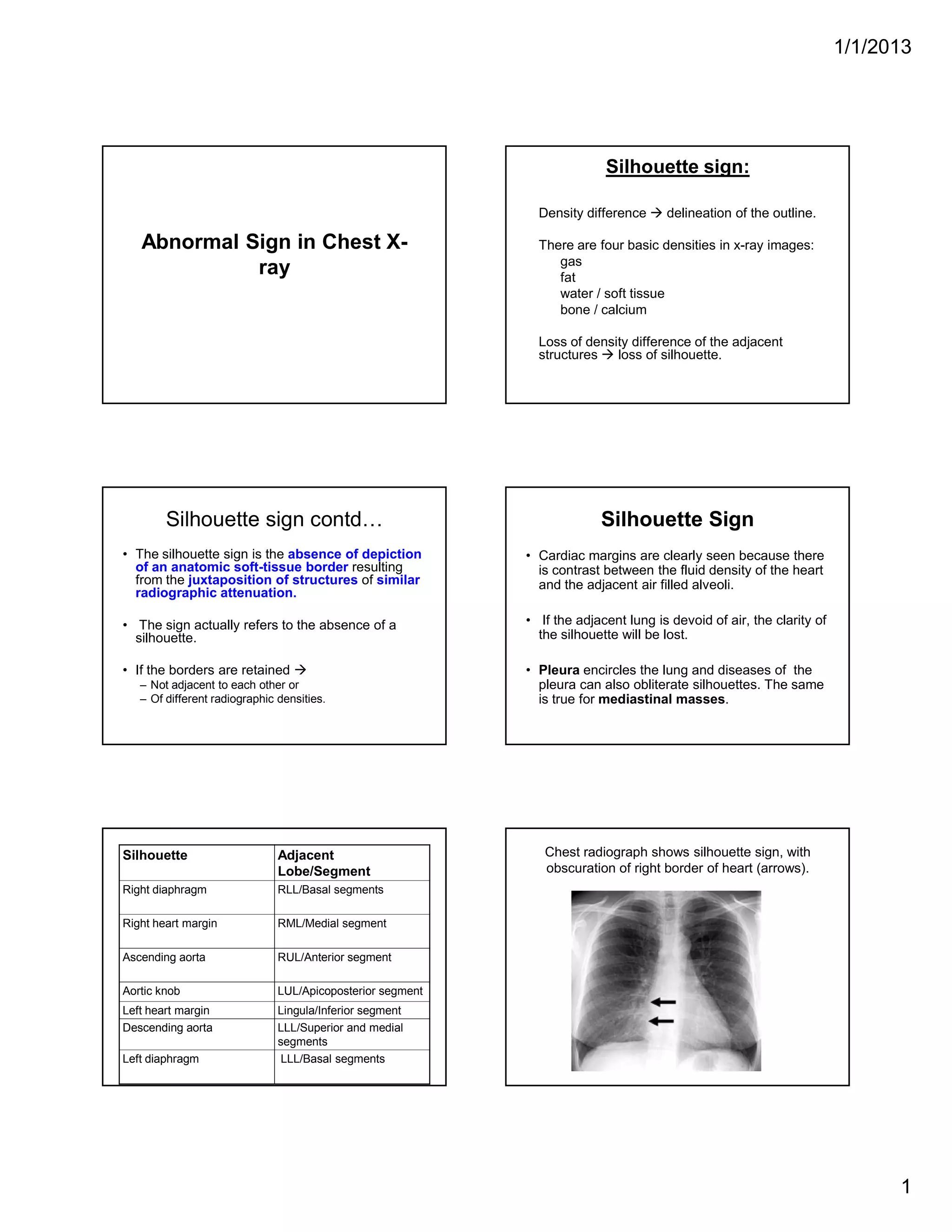 Abnormal sign in chest X- Ray | PDF