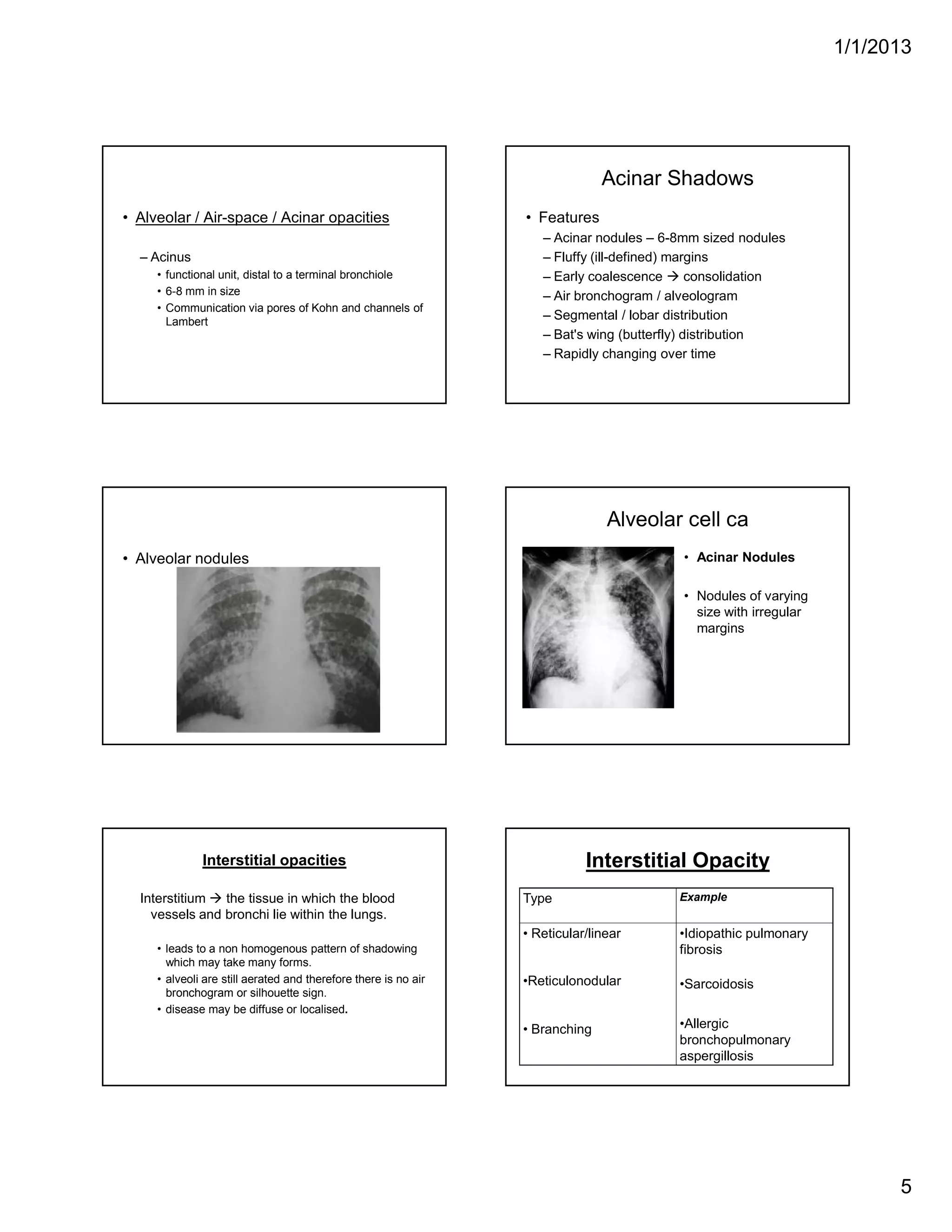 Abnormal sign in chest X- Ray | PDF | Lung and Respiratory Health ...