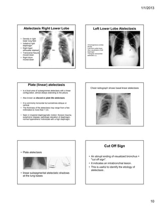 Abnormal sign in chest X- Ray | PDF | Lung and Respiratory Health ...