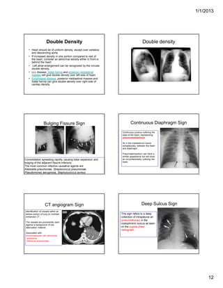 Abnormal sign in chest X- Ray | PDF | Lung and Respiratory Health ...