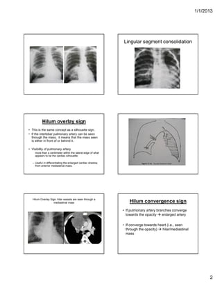 Abnormal sign in chest X- Ray | PDF | Lung and Respiratory Health ...
