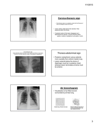 Abnormal sign in chest X- Ray | PDF | Lung and Respiratory Health ...