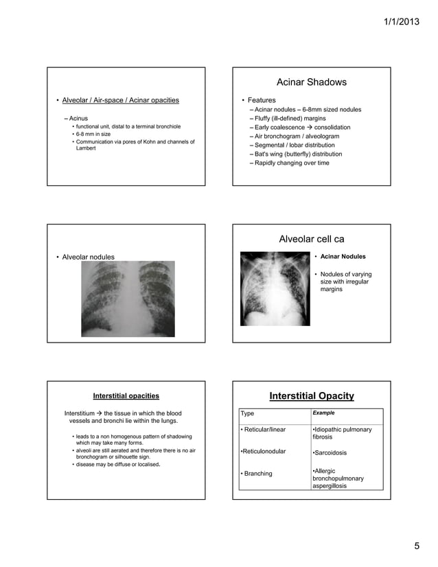 Abnormal sign in chest X- Ray | PDF
