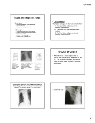 Abnormal sign in chest X- Ray | PDF | Lung and Respiratory Health ...