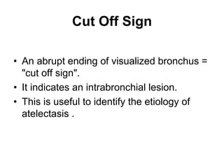 Abnormal signs in chest x ray | PPT