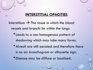 Abnormal signs on a Chest X-Ray (Plain Radiograph) | PPT