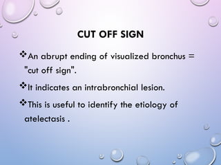 Abnormal signs on a Chest X-Ray (Plain Radiograph) | PPT