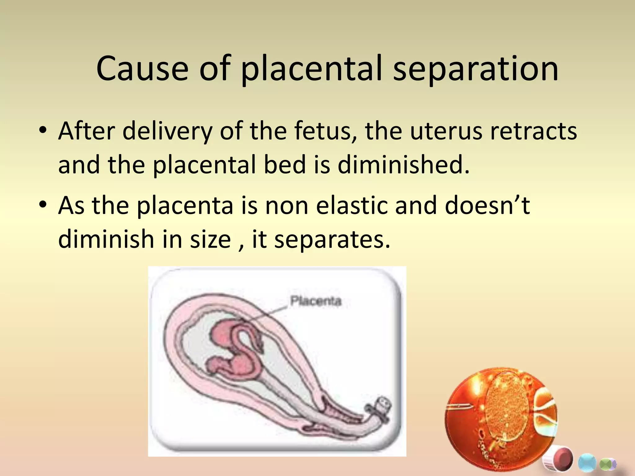 Abnormal third stage | PPTX