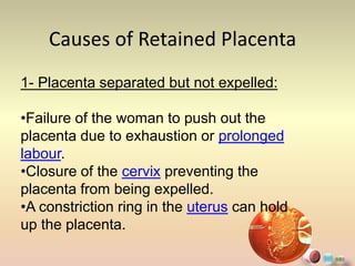 Abnormal third stage | PPTX