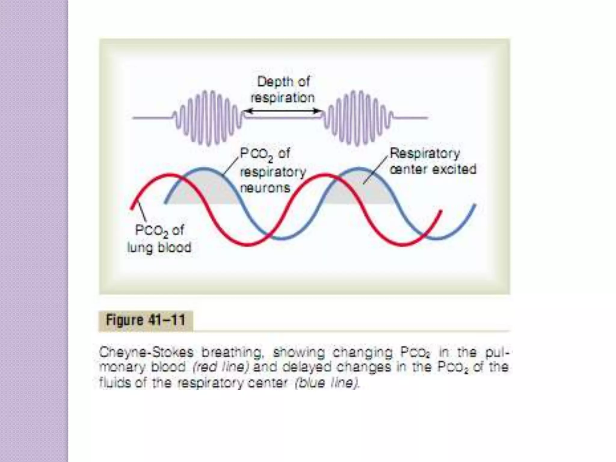 Abnormal types of respiration, HYPOXIA, ASPHYXIA, Cyanosis (The guyton ...
