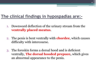 Abnormal Urethral opening - Hypospadias & Epispadias.pptx