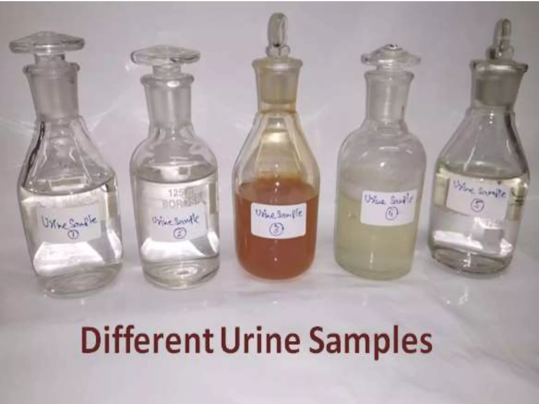Abnormal Urine.pptx
