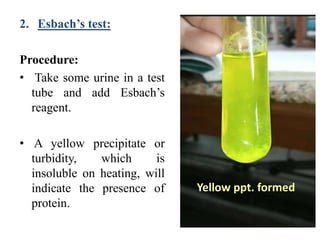 Abnormal Urine.pptx