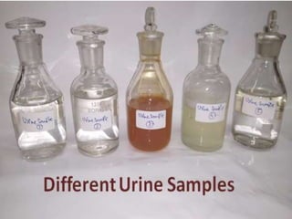 Abnormal Urine.pptx