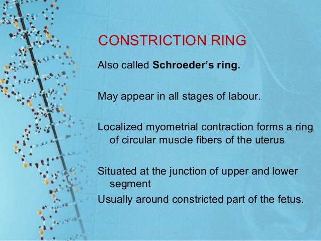 Uterus Contraction Ring Obstructed Labour