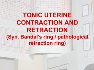 Abnormal uterine action | PPT