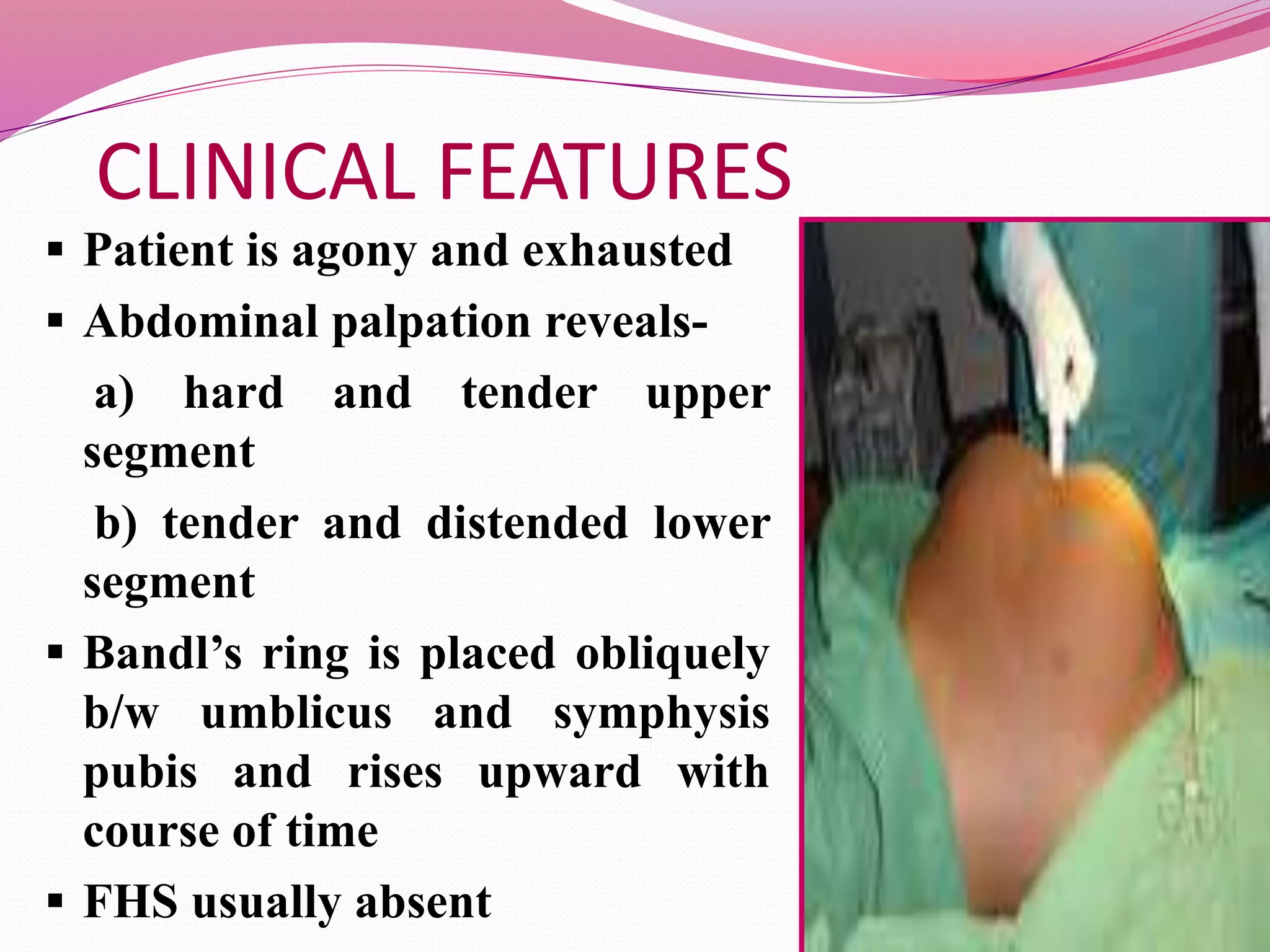 Abnormal uterine action | PPTX