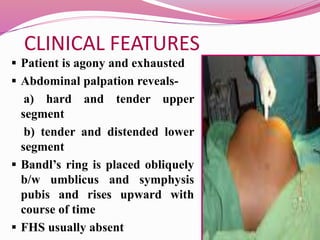 Abnormal uterine action | PPTX