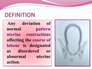 Abnormal uterine action | PPTX