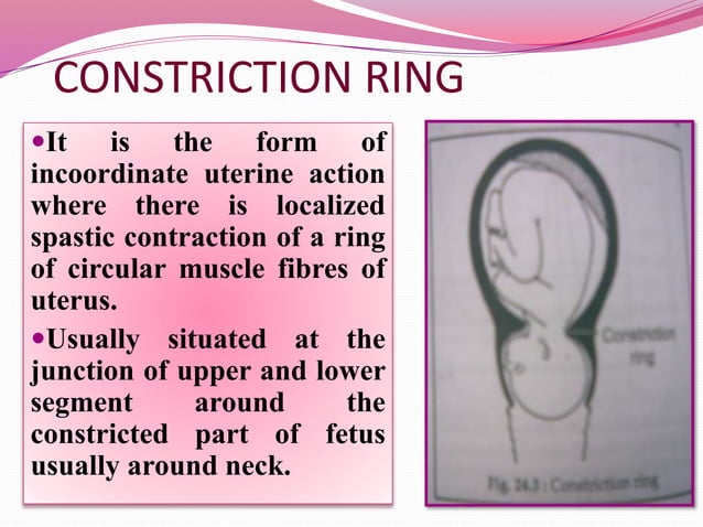 Abnormal uterine action | PPTX