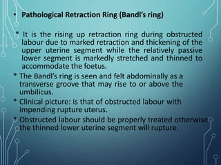 Abnormal uterine action | PPT