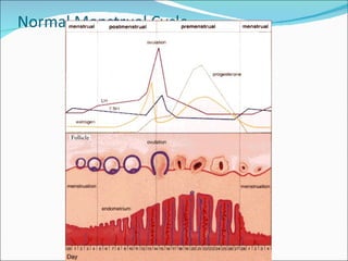 Abnormal uterine bleeding and Management | PPT
