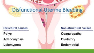 Abnormal uterine bleeding | PPTX