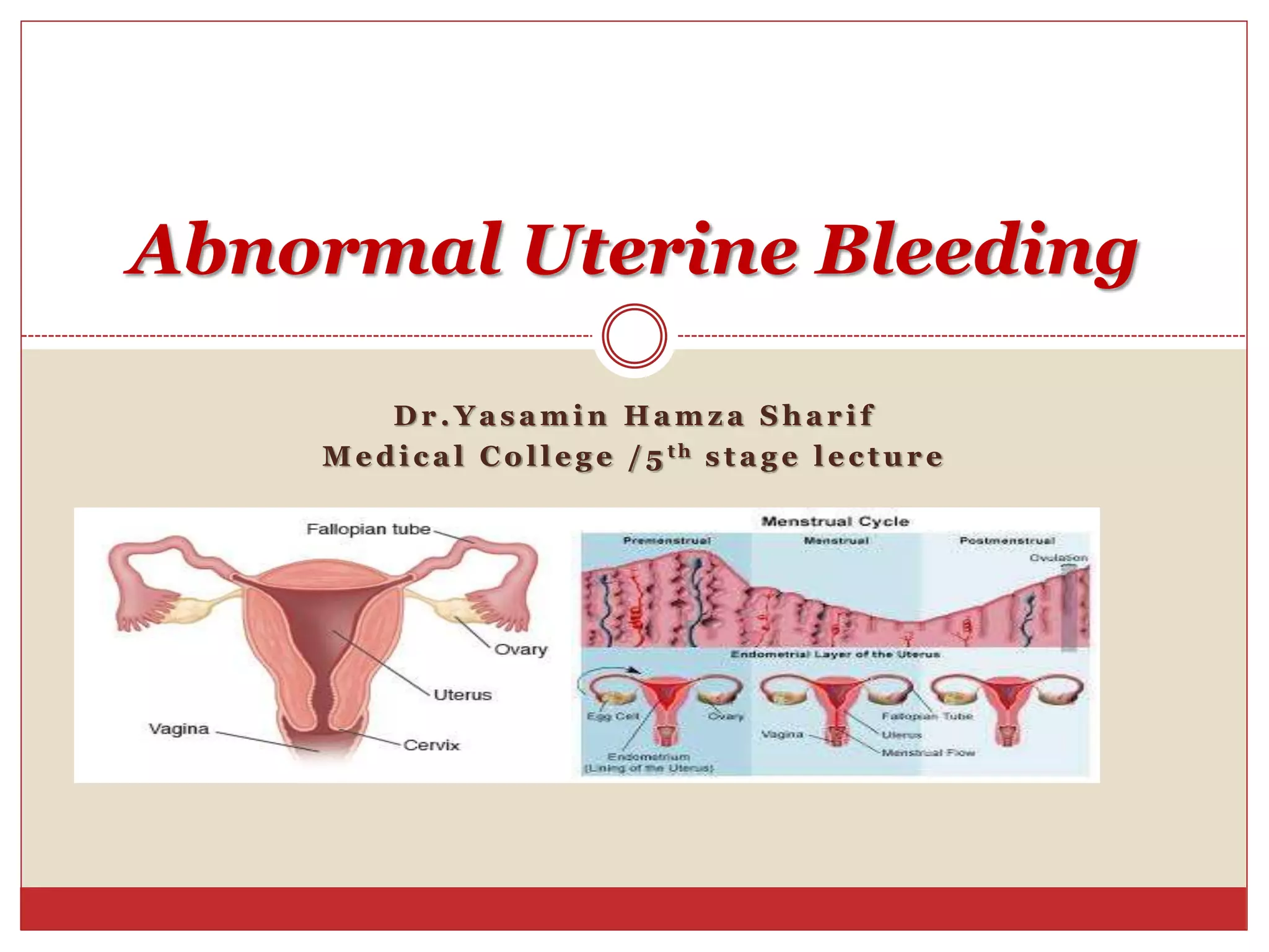 Abnormal Uterine Bleeding .pptx