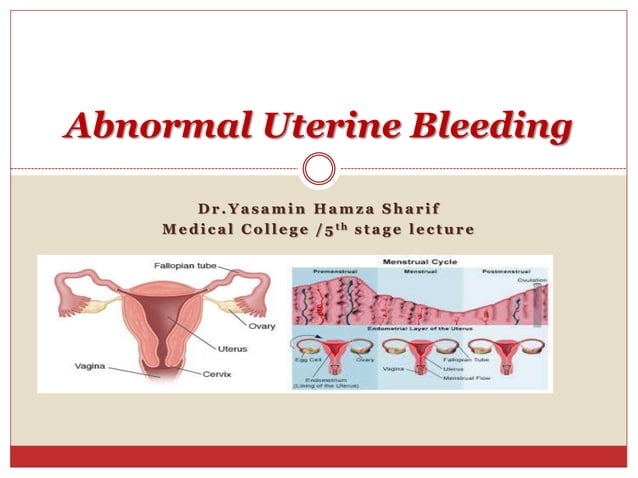 Abnormal Uterine Bleeding .pptx