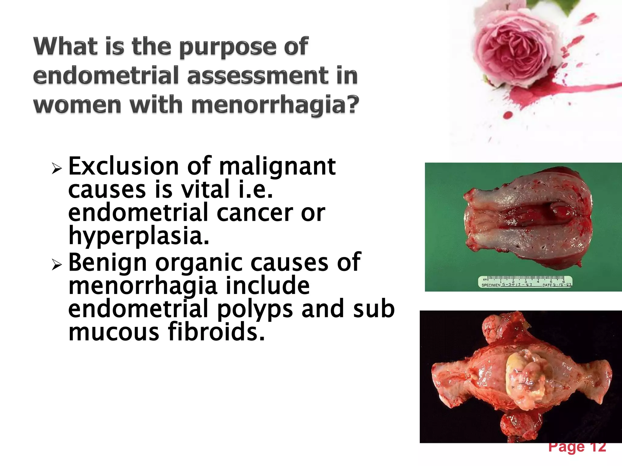 Abnormal uterine bleeding prof jamiyah hassan | PDF